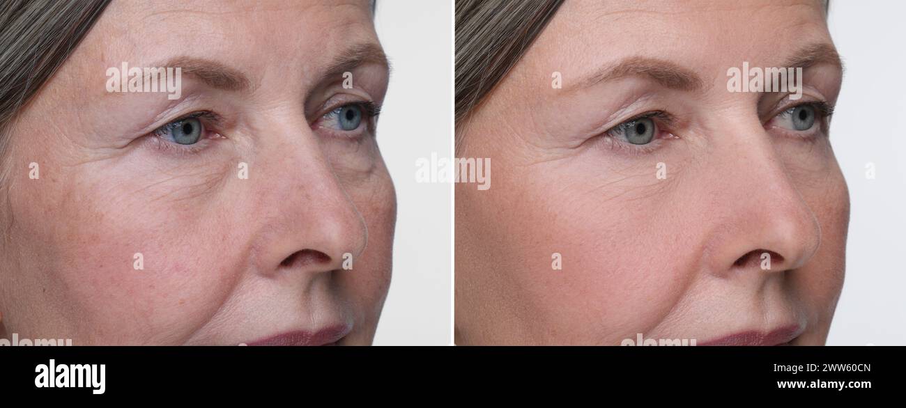 Aging skin changes. Collage with photos of mature woman before and ...