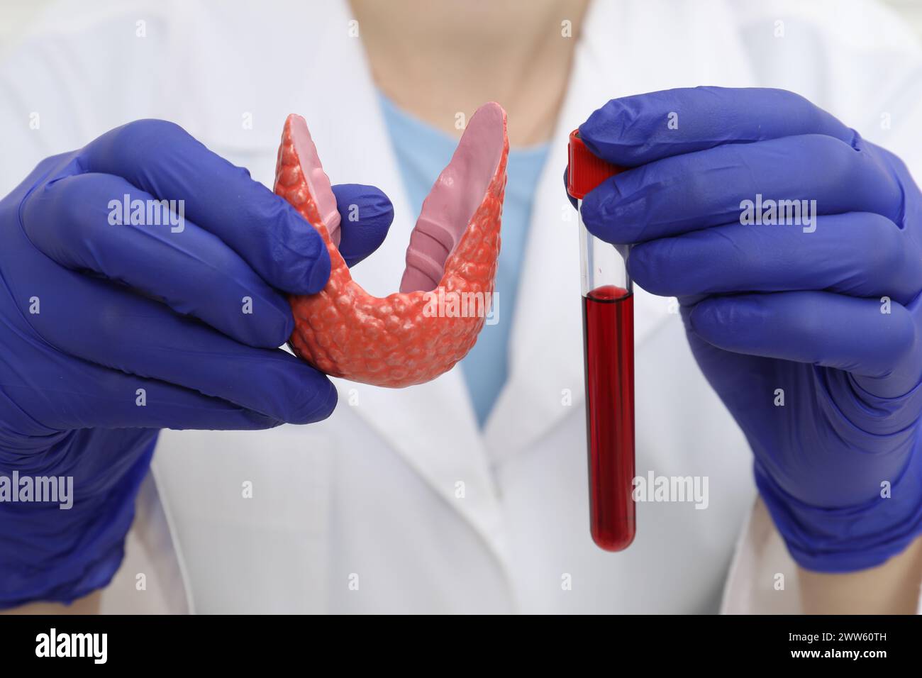 Endocrinologist showing thyroid gland model and blood sample in test ...