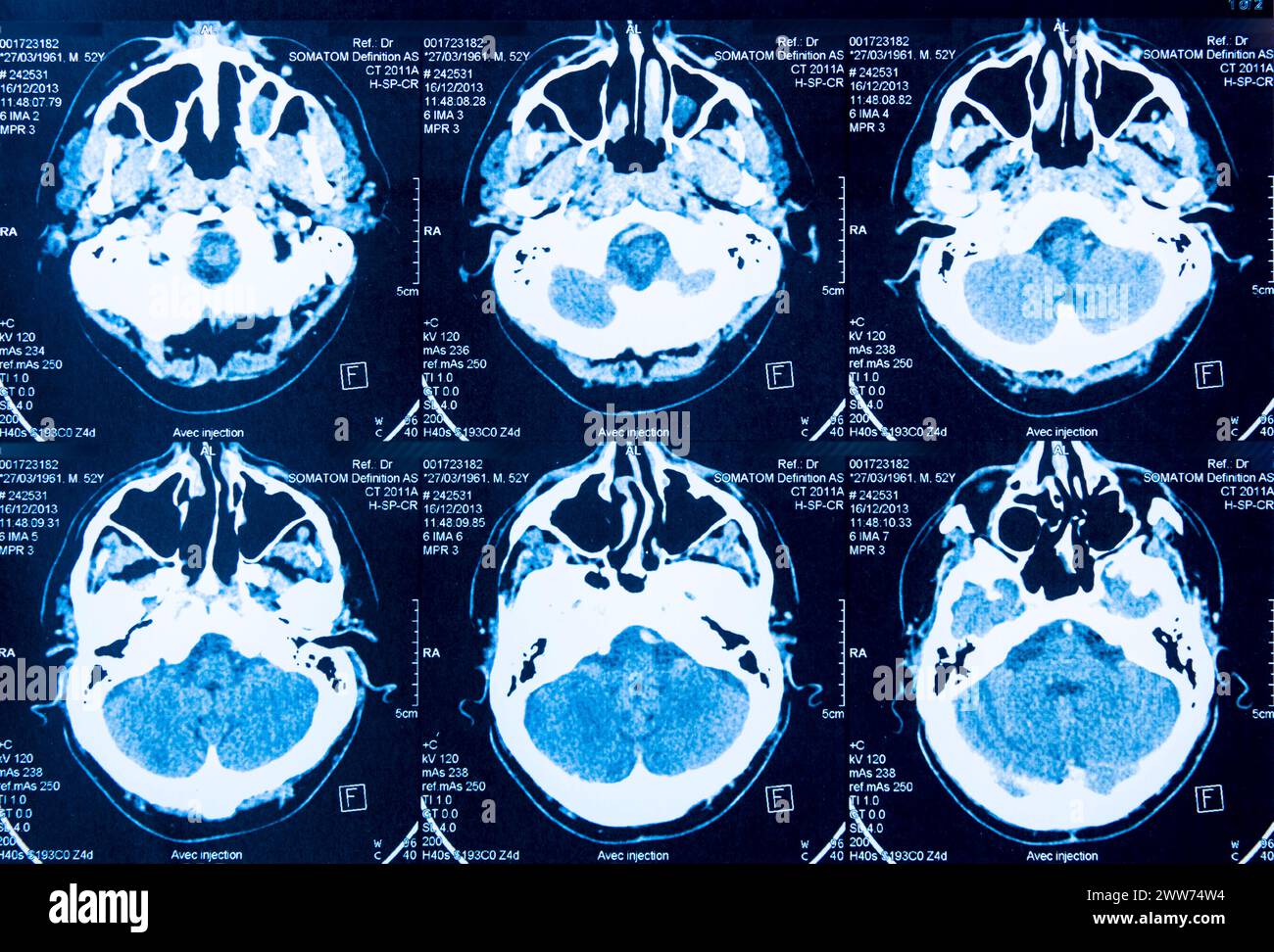 Full body scanner hi-res stock photography and images - Alamy