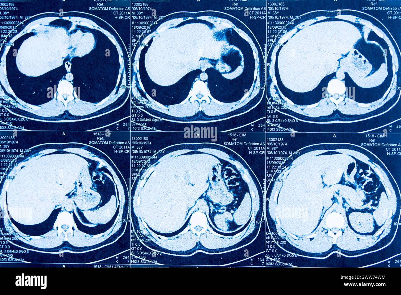 Full body scan hi-res stock photography and images - Alamy