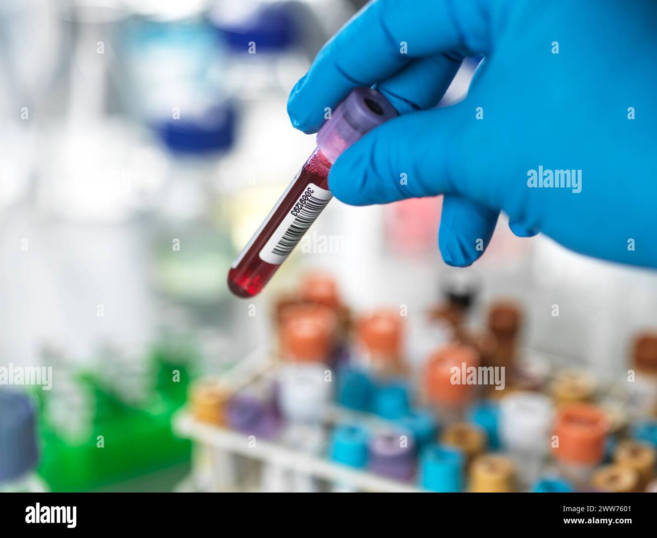 Medical Testing, Blood sample being prepared for analysis Stock Photo ...