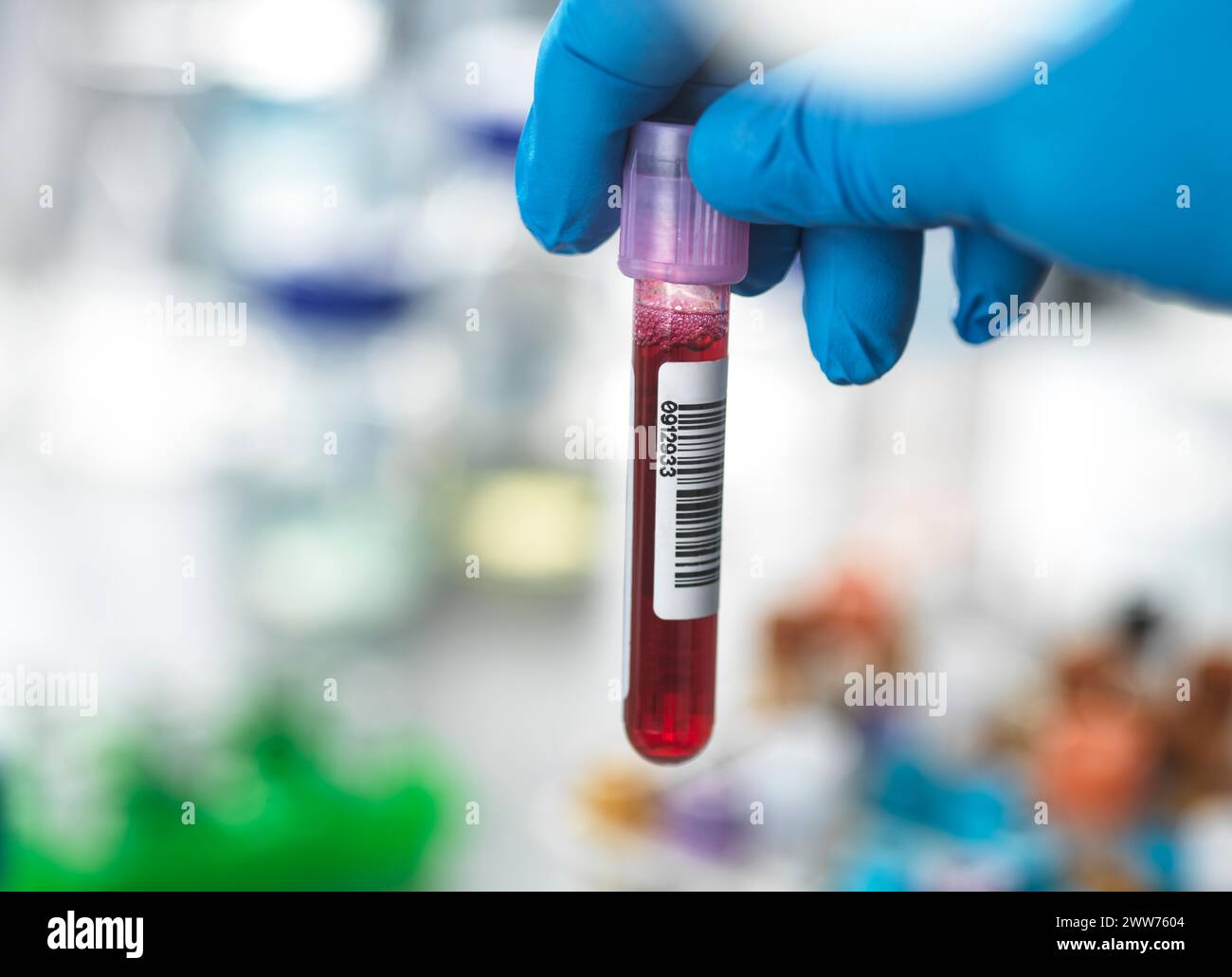 Human testing hi-res stock photography and images - Alamy