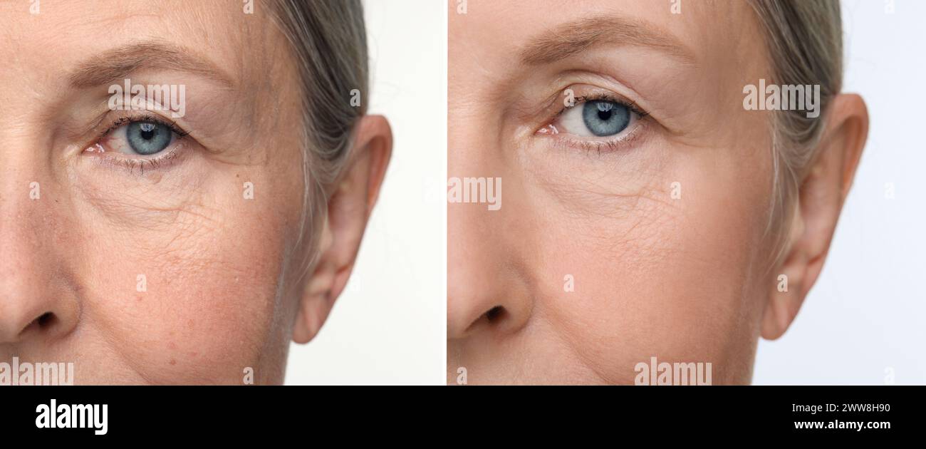 Aging skin changes. Collage with photos of mature woman before and ...
