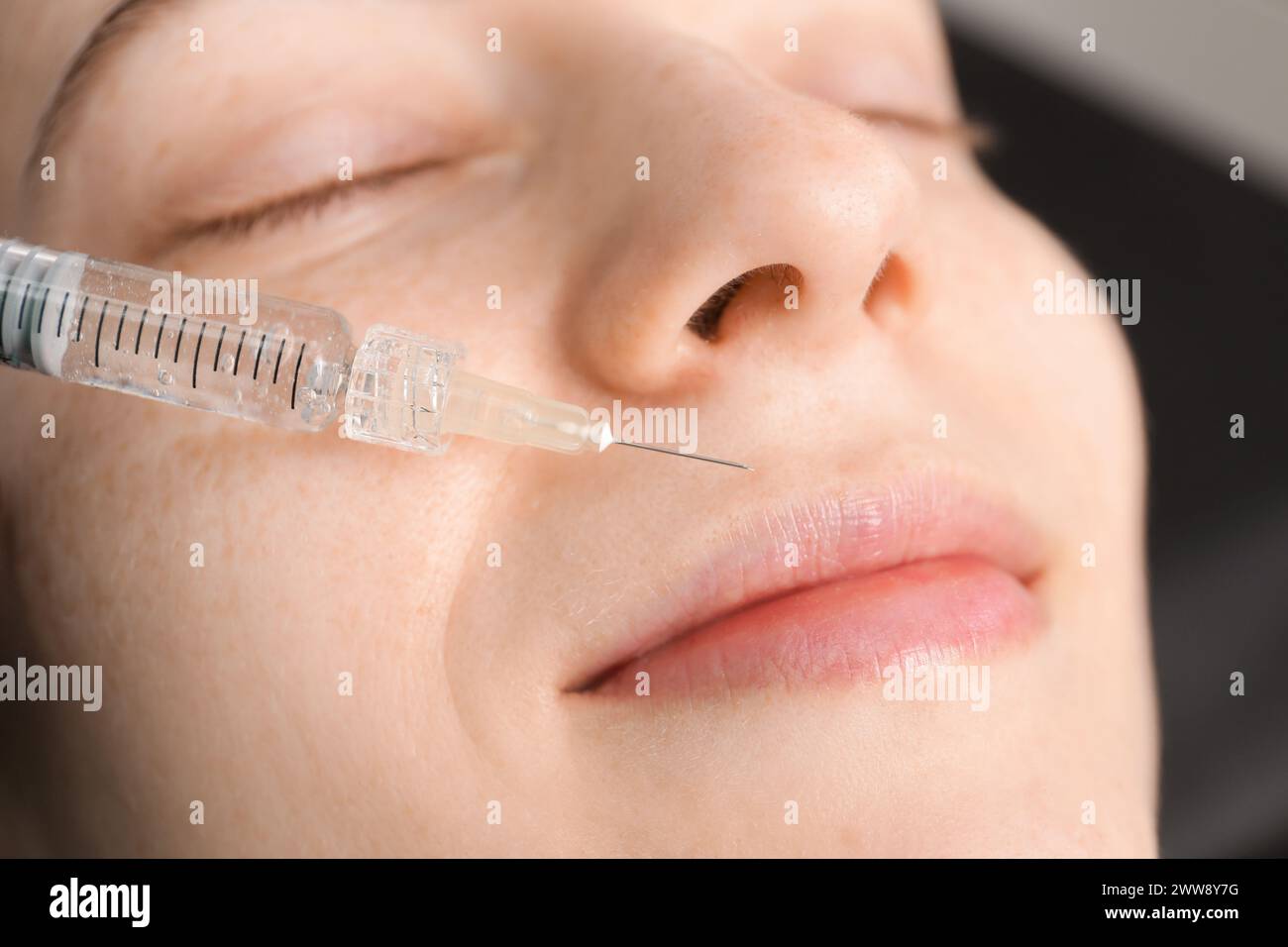 Client getting lips injection, closeup. Cosmetology procedure Stock ...