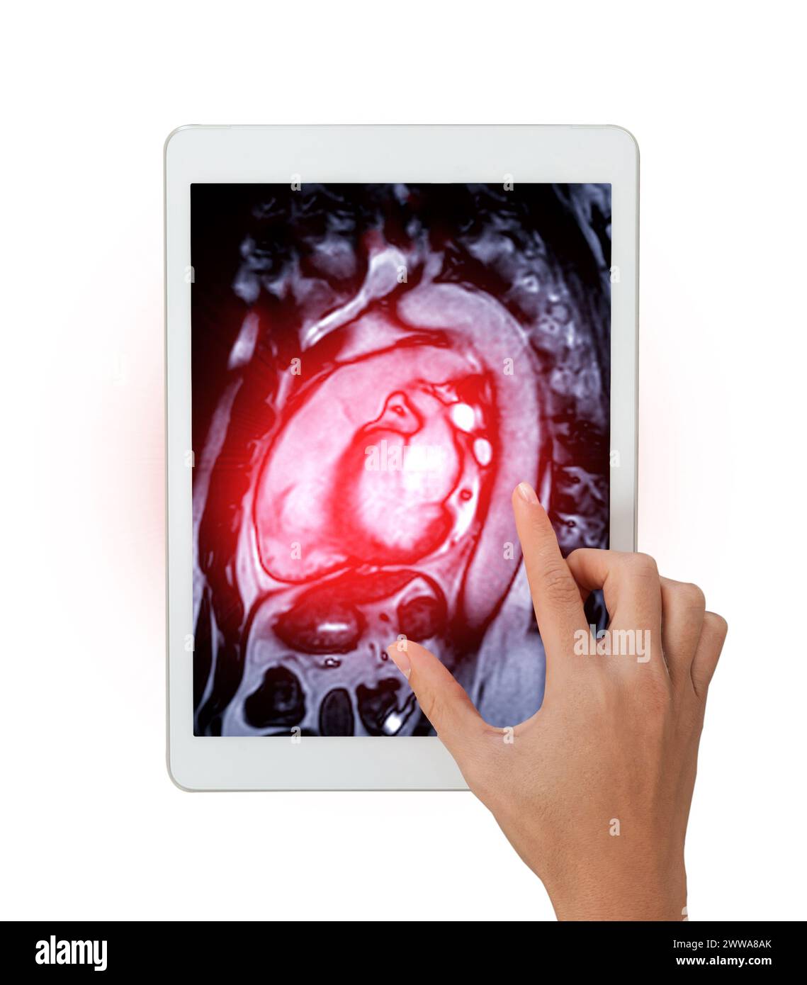 Cardiac MRI images on Tablet are instrumental in assessing cardiac ...