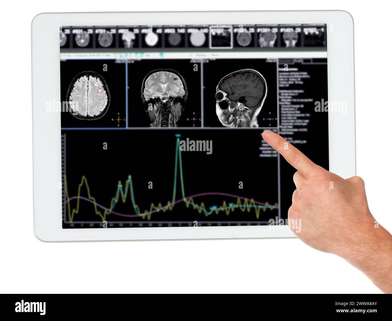 Mr spectroscopy hi-res stock photography and images - Alamy