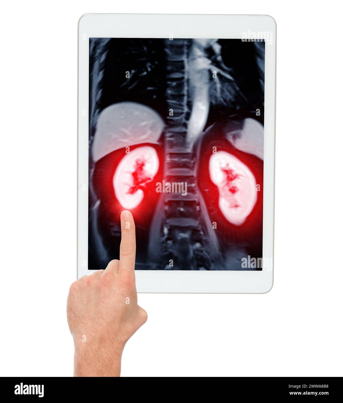 MRI of the upper abdomen coronal view is a non-invasive imaging ...