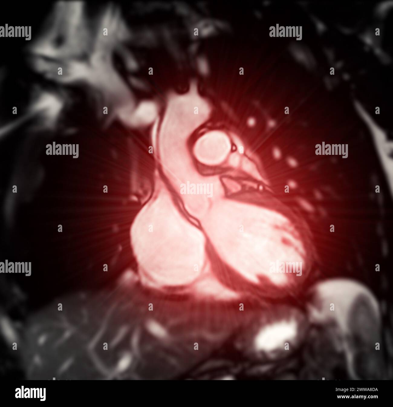 Cardiac MRI evaluates heart health, providing detailed images for ...