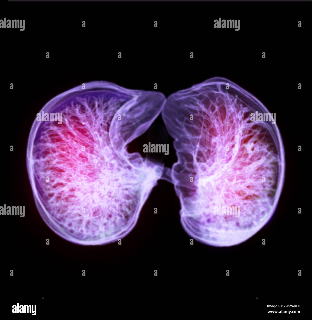CT Chest or Lung 3d rendering image showing Trachea and lung in ...