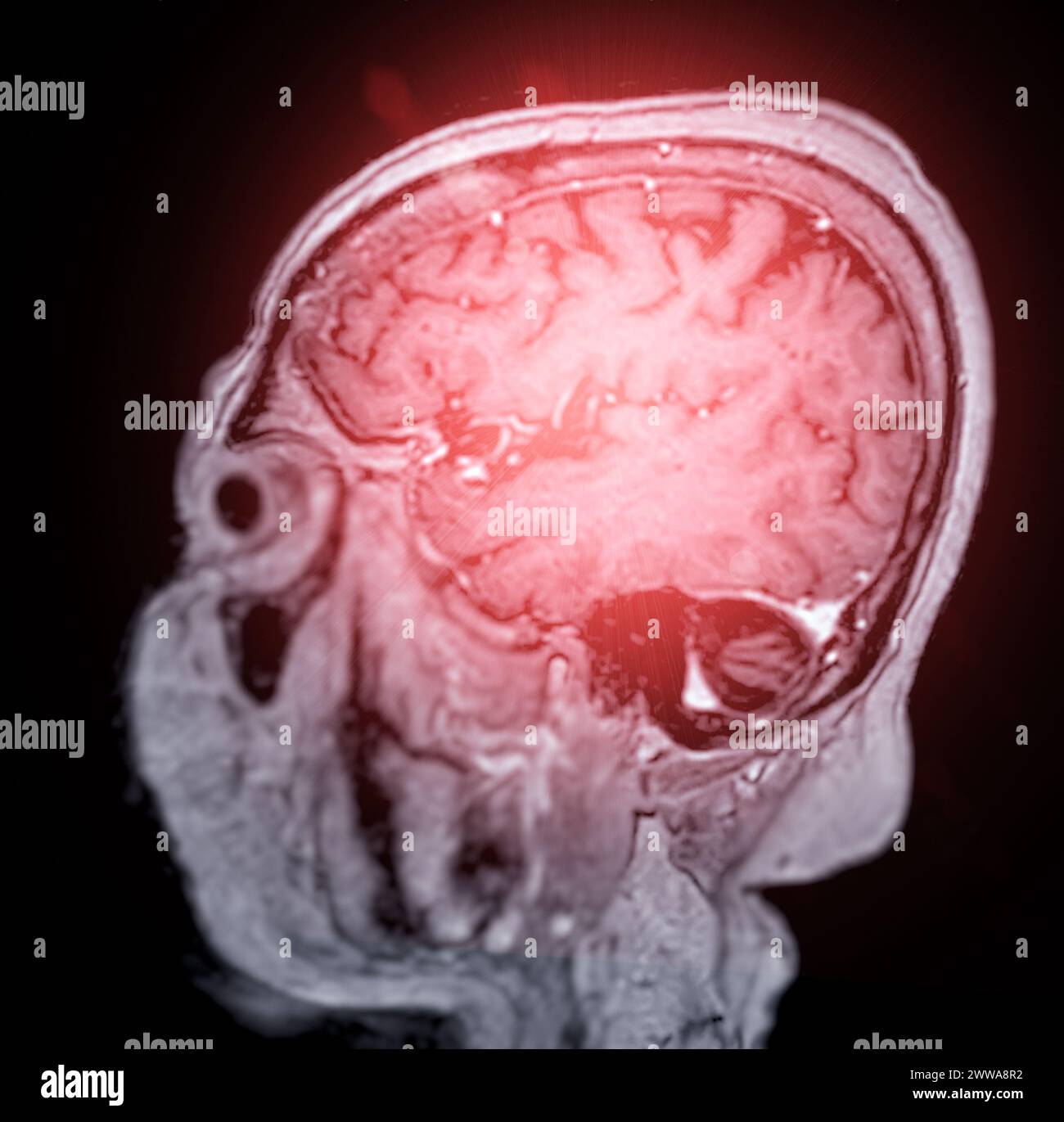 Mri Brain Scan Sagittal Plane For Detect Brain Diseases Sush As Stroke Disease Brain Tumors And