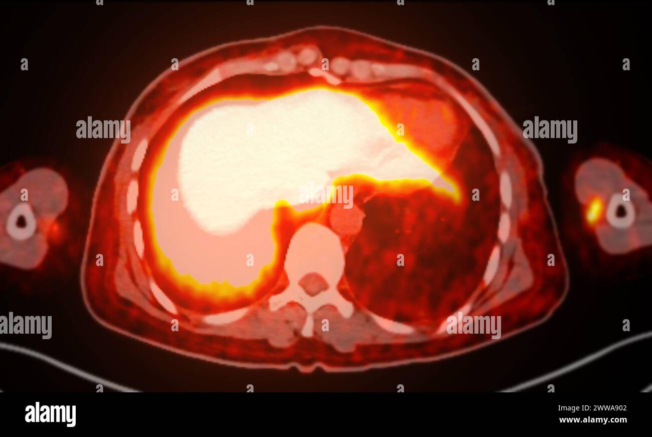 Pet ct anatomy hi-res stock photography and images - Alamy