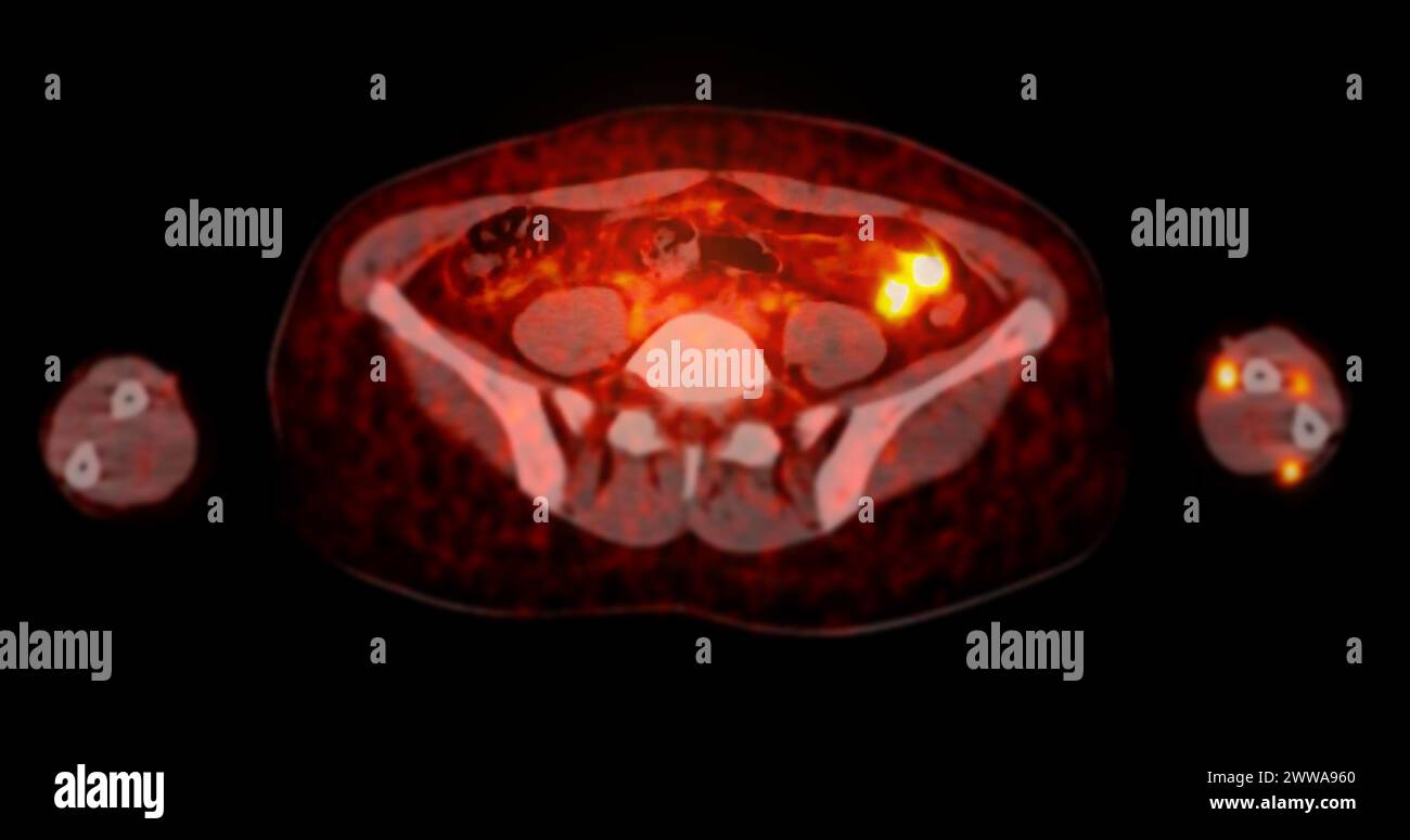 Brain pet scan screen hi-res stock photography and images - Alamy