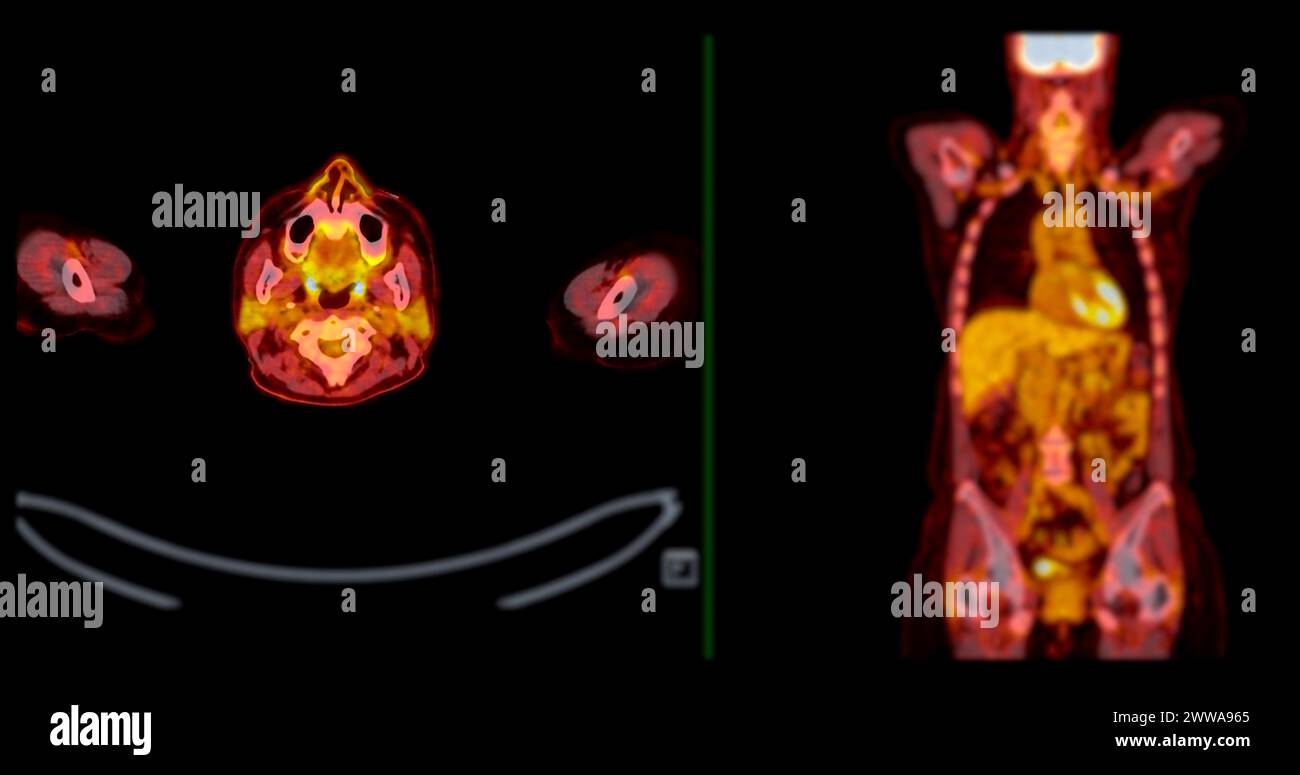 Pet brain tumor scan hi-res stock photography and images - Alamy