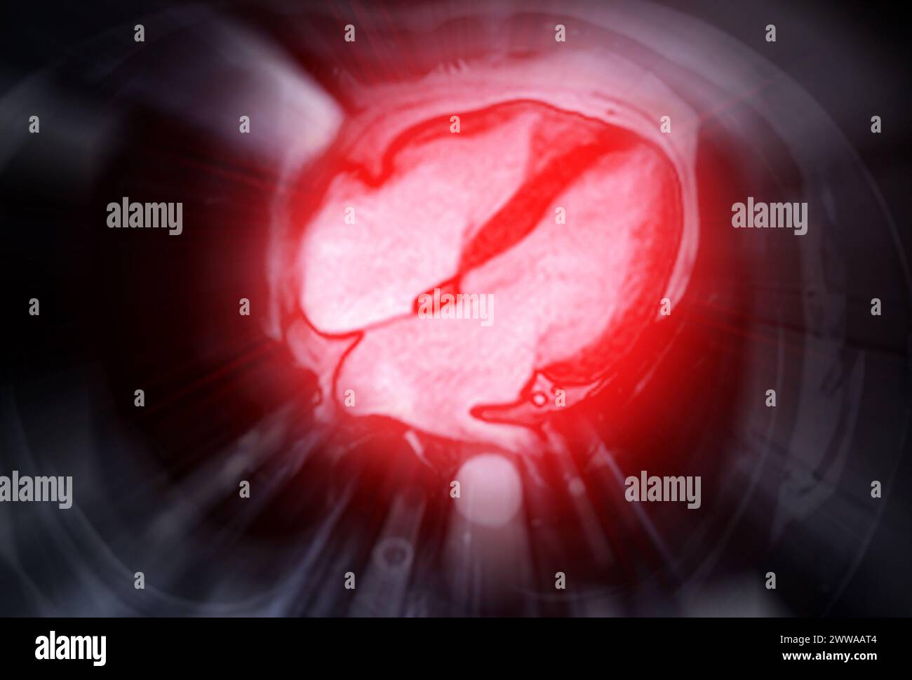 Cardiac MRI images are instrumental in assessing cardiac health ...