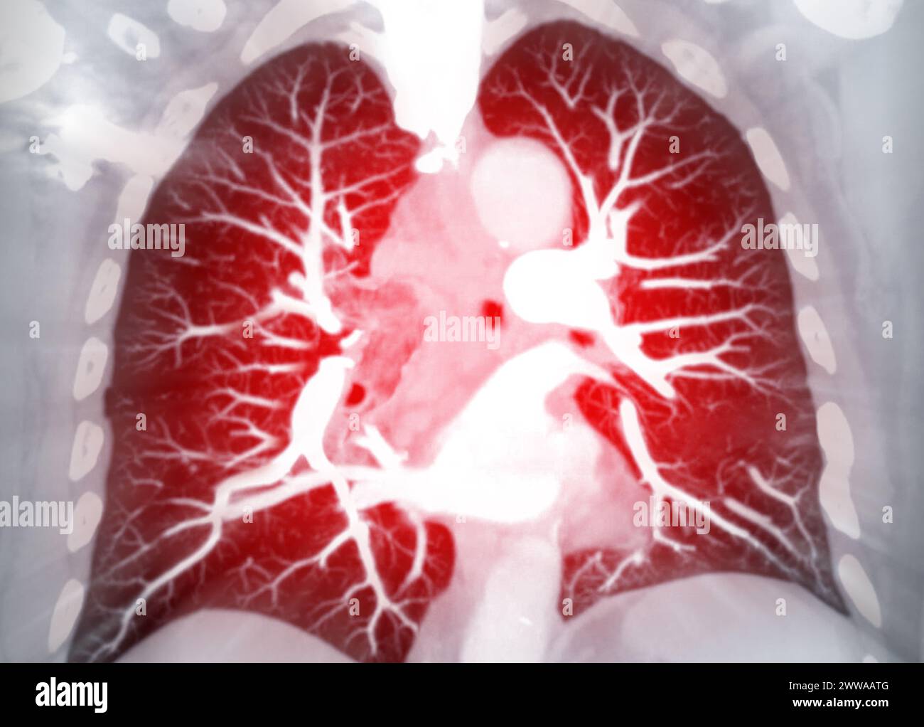 Arteries of thorax hi-res stock photography and images - Alamy
