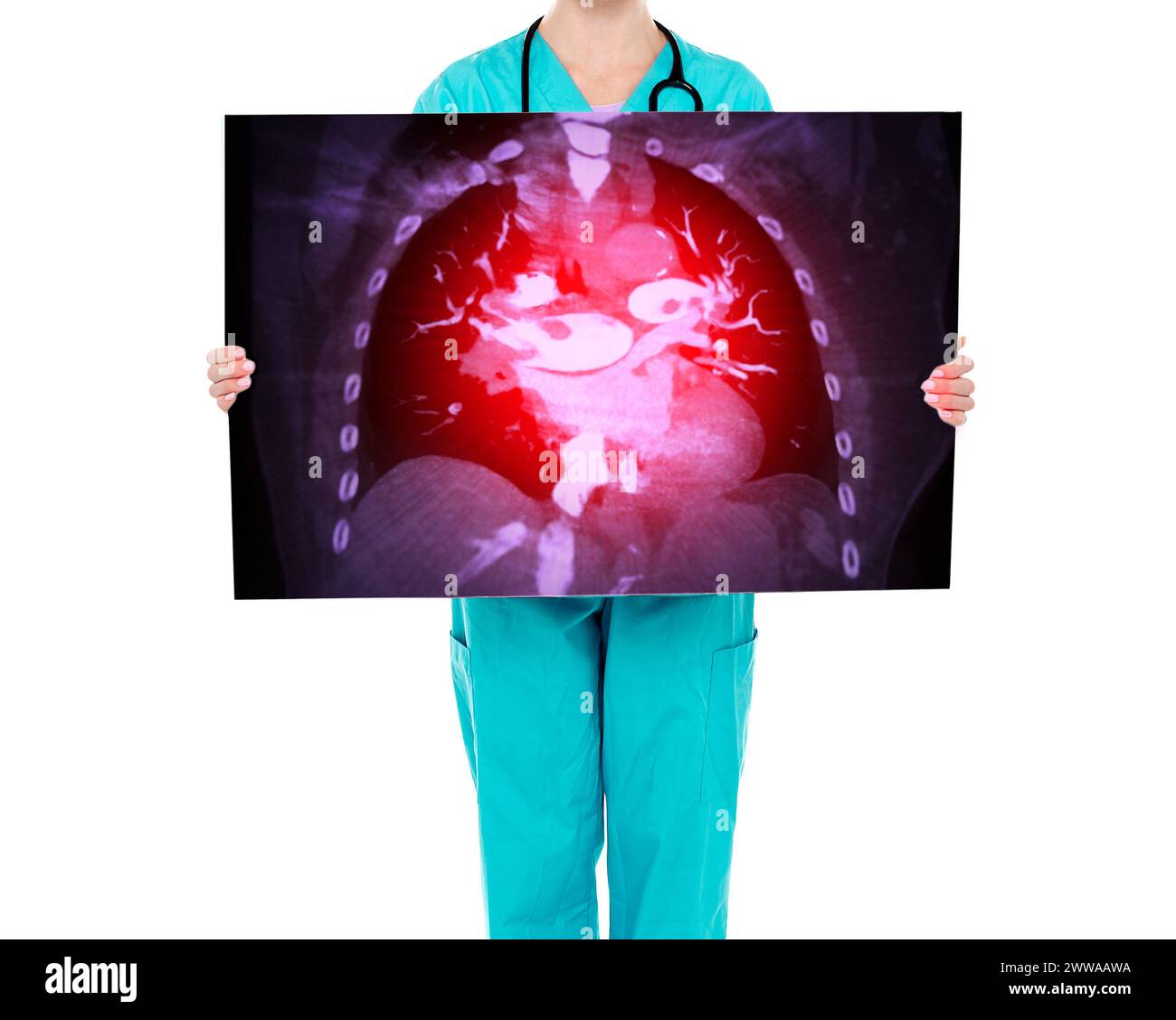 The doctor uses the image as an educational tool, simplifying the ...