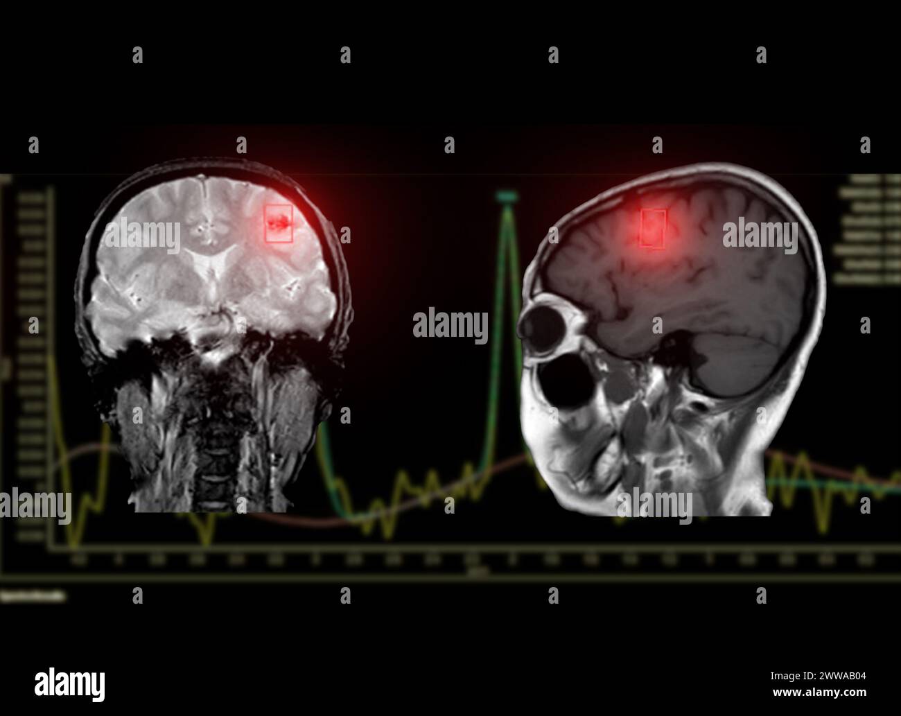 Mr spectroscopy hi-res stock photography and images - Alamy
