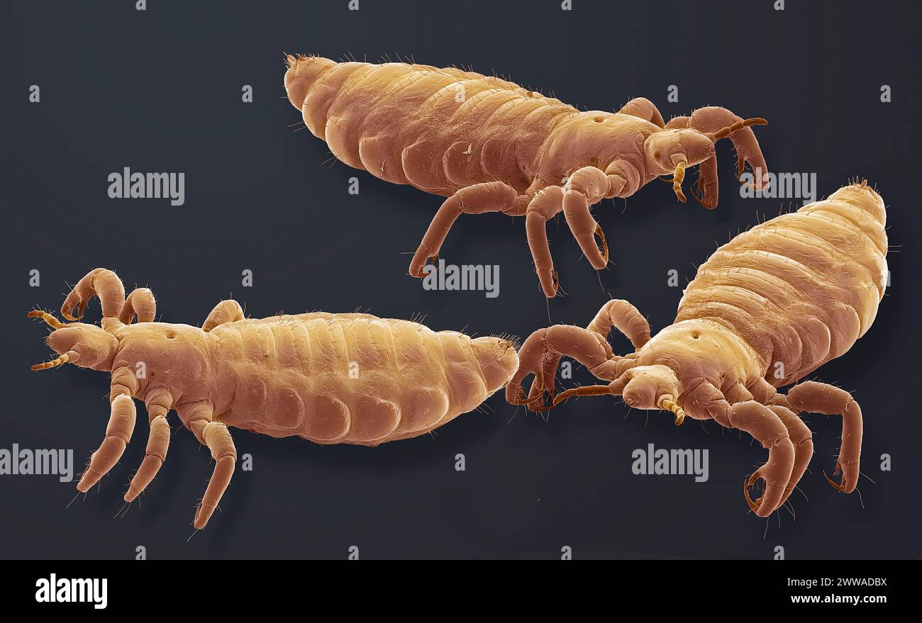 Head lice. Coloured scanning electron micrograph (SEM) of head lice ... Head lice. Coloured scanning electron micrograph (SEM) of head lice ...