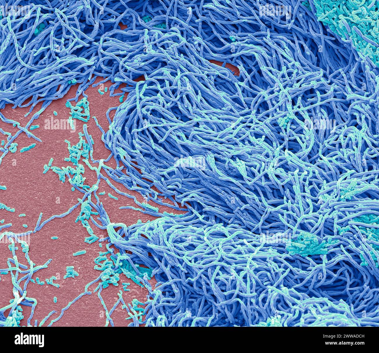 Human feces hi-res stock photography and images - Alamy