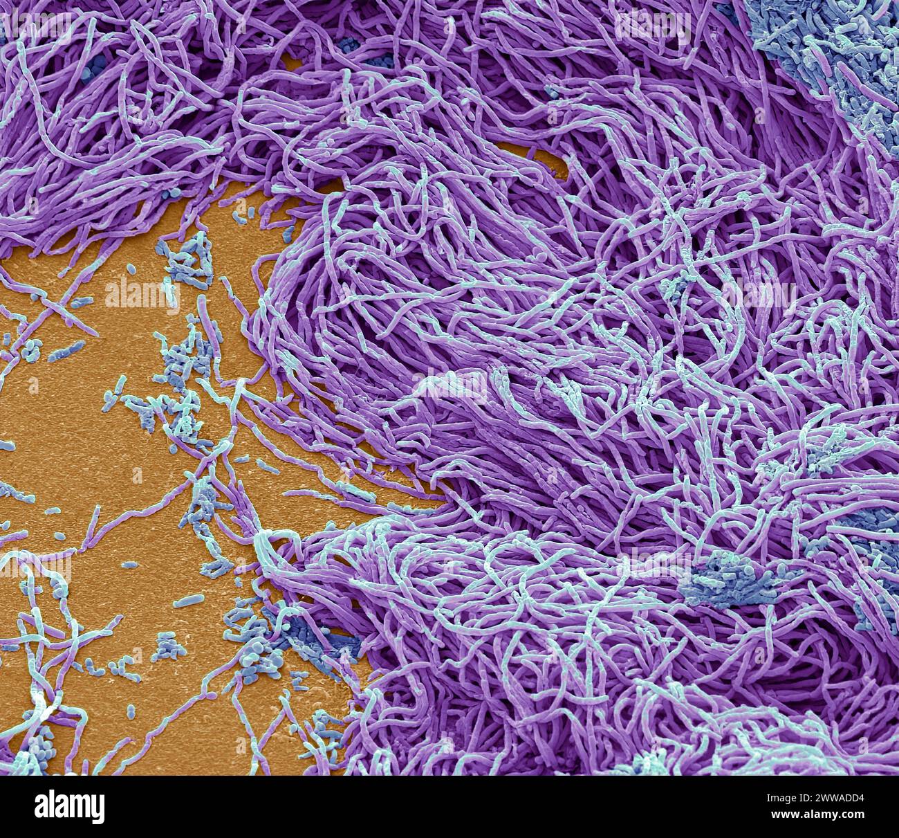 Faecal bacteria. Scanning electron micrograph (SEM) of bacteria ...