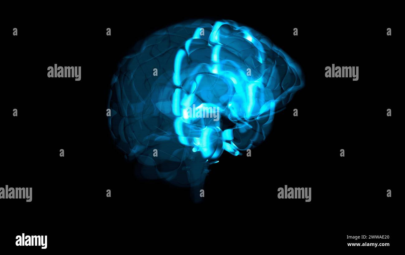 Brain scan, conceptual illustration Stock Photo - Alamy