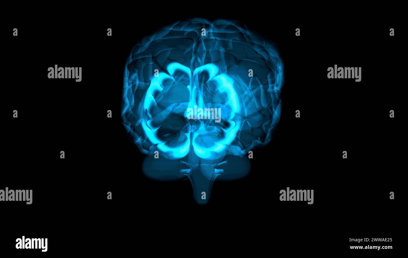 Brain scan, conceptual illustration Stock Photo - Alamy