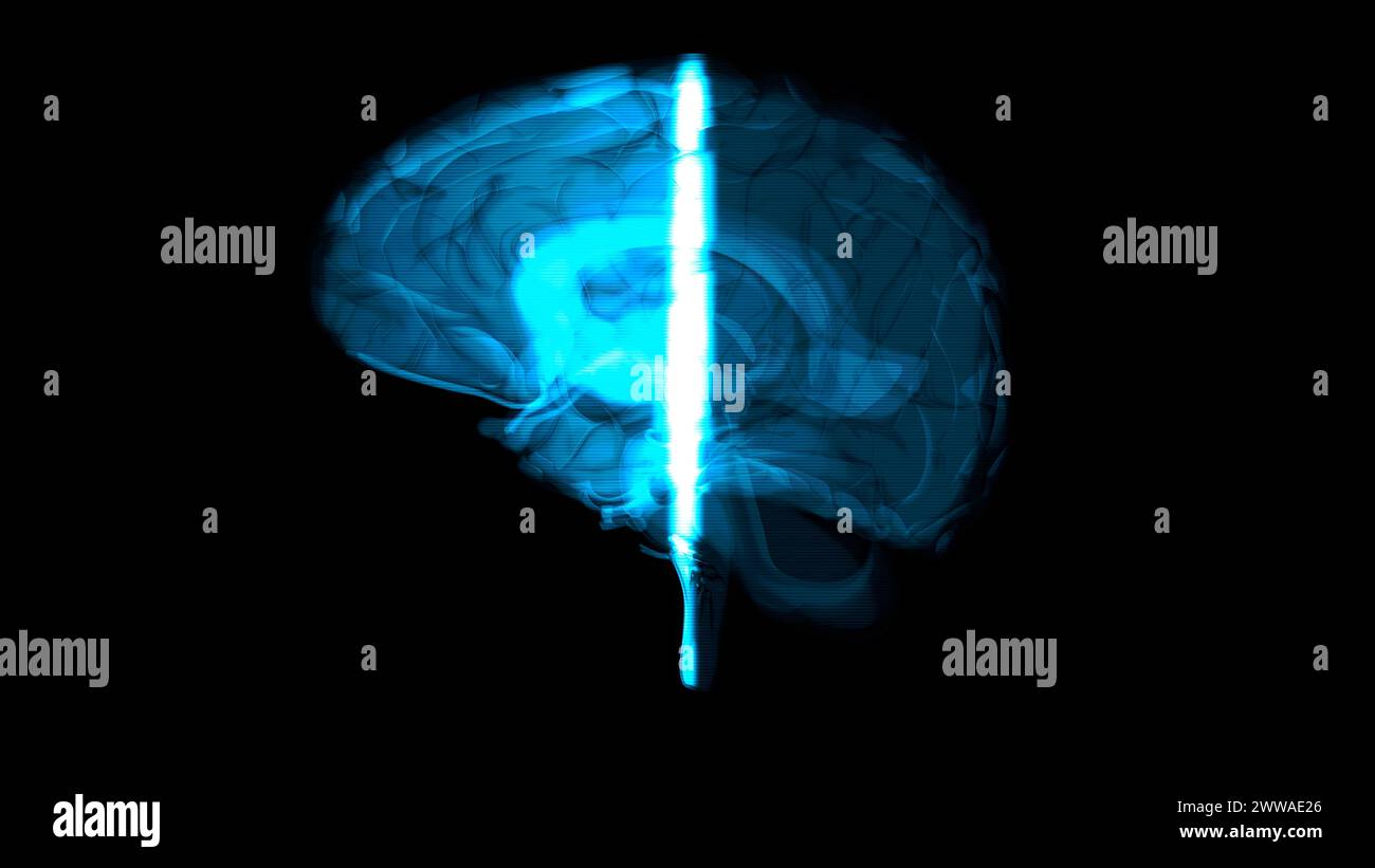 Brain scan, conceptual illustration Stock Photo - Alamy
