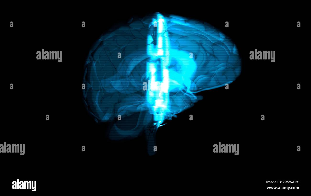 Brain scan, conceptual illustration Stock Photo - Alamy