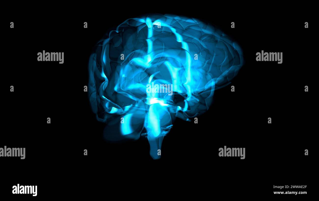 Brain scan, conceptual illustration Stock Photo - Alamy