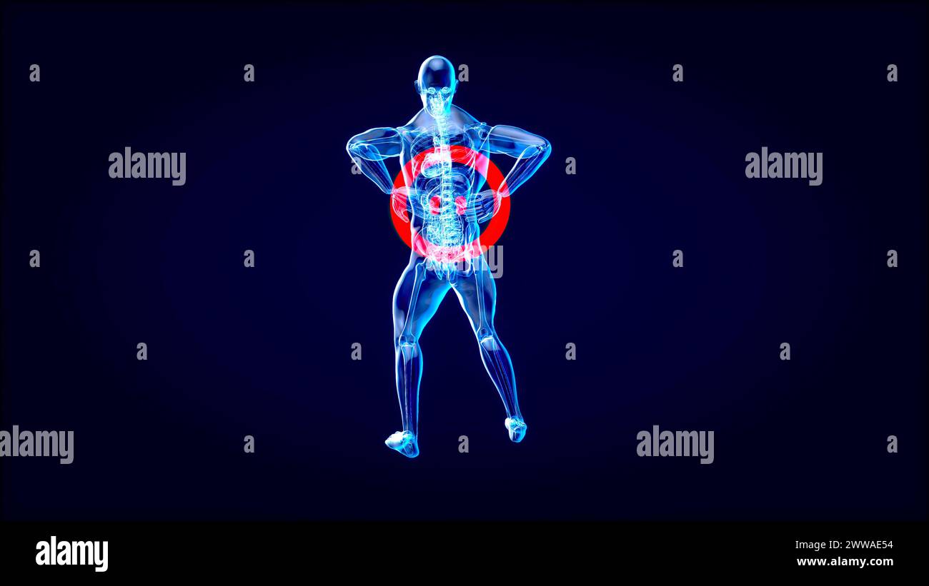 Kidney pain, conceptual illustration Stock Photo - Alamy