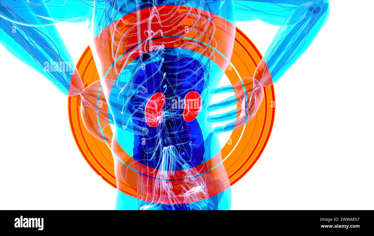 Kidney pain, conceptual illustration Stock Photo - Alamy