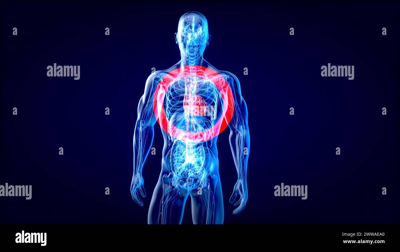 Heart attack, conceptual illustration Stock Photo - Alamy
