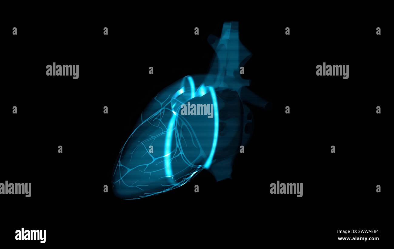 Heart scan hi-res stock photography and images - Alamy