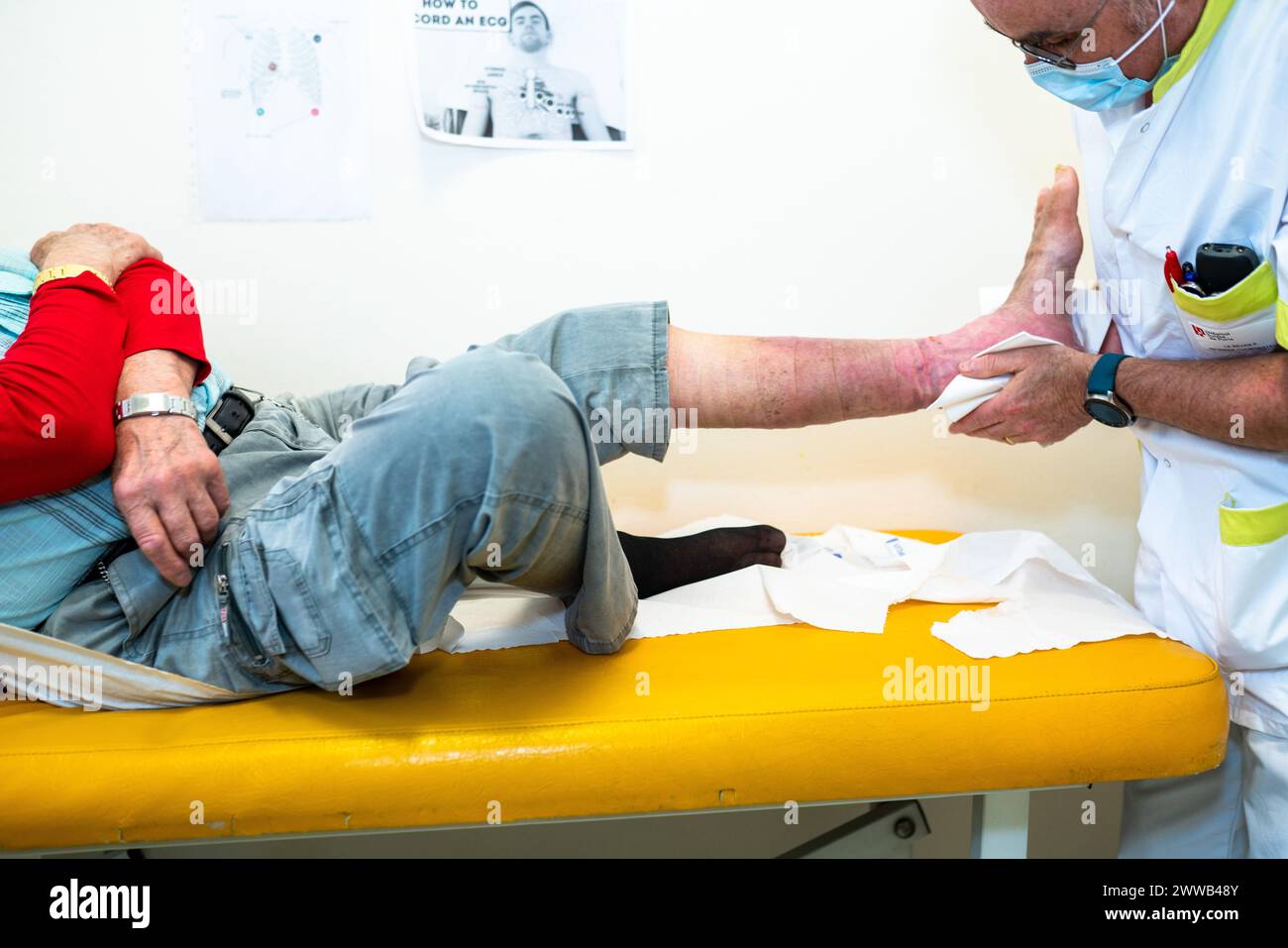 Care of a patient's foot ulcer. Wound cleaning and dressings Stock ...