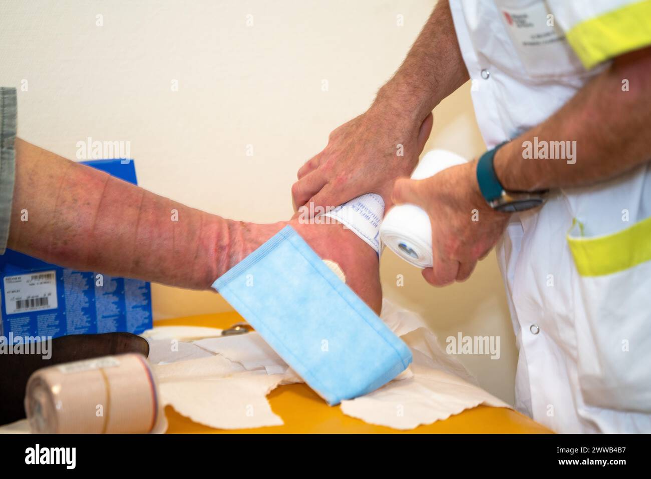 Care of a patient's foot ulcer. Wound cleaning and dressings Stock ...
