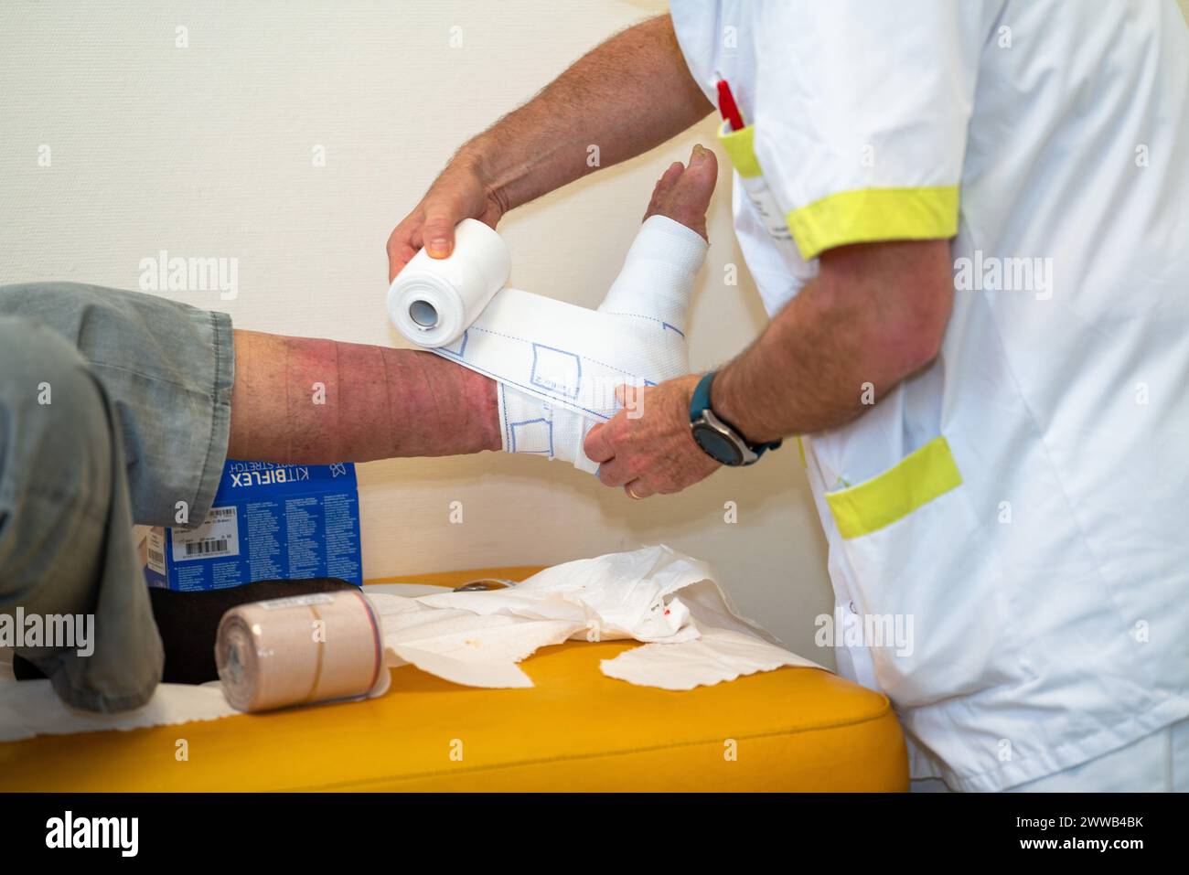 Care of a patient's foot ulcer. Wound cleaning and dressings Stock ...