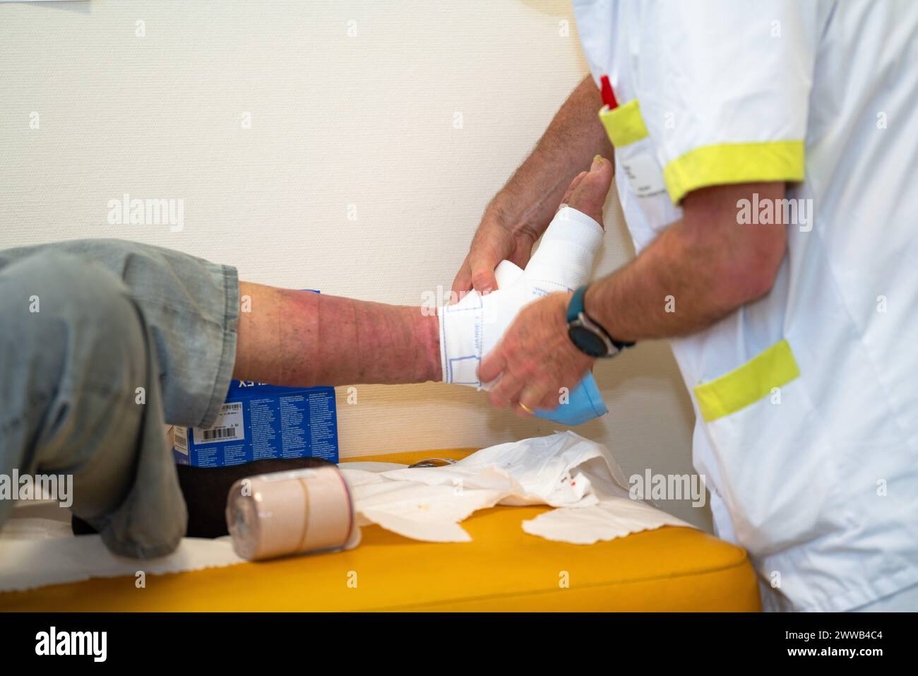 Care of a patient's foot ulcer. Wound cleaning and dressings Stock ...