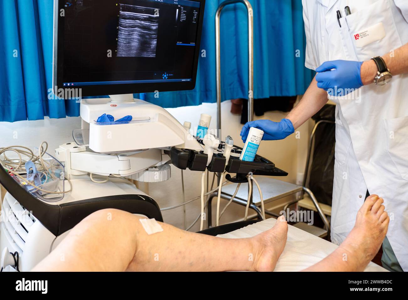 Treatment of varicose veins by foam echosclerotherapy, injection into a ...
