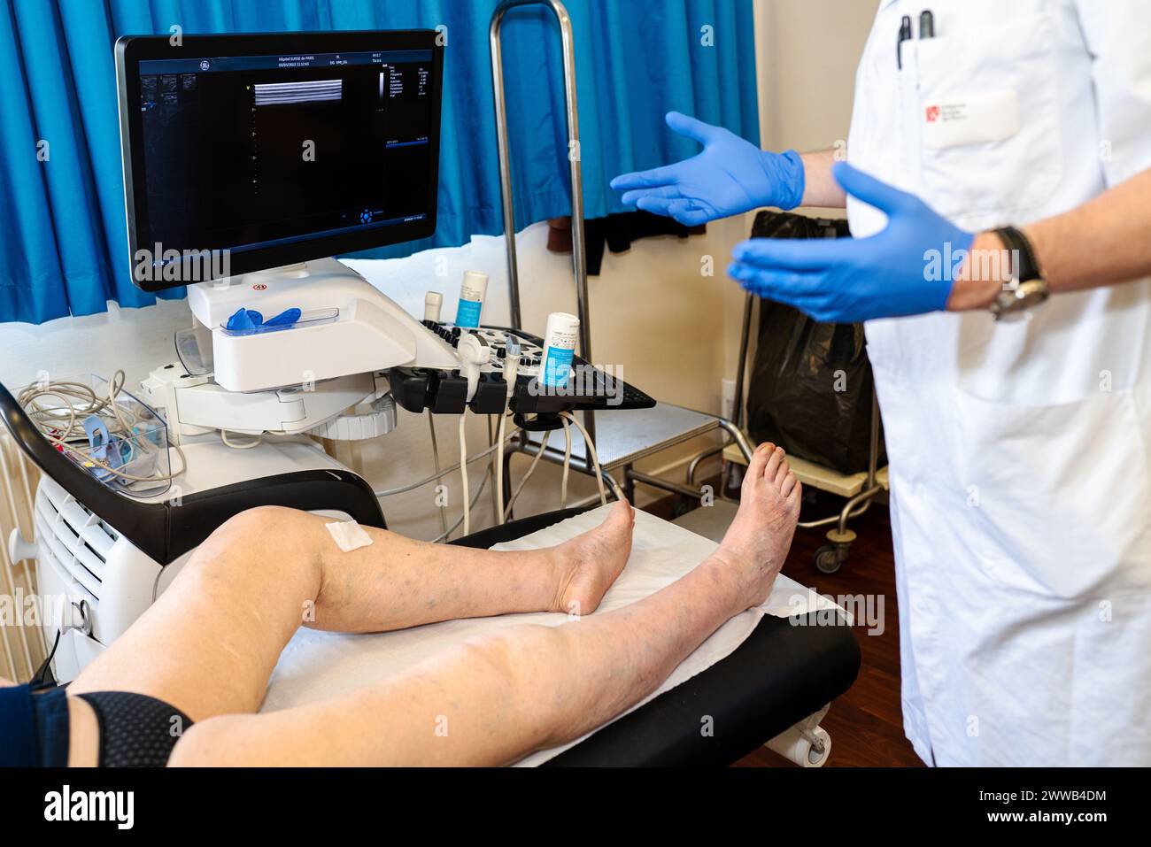 Treatment of varicose veins by foam echosclerotherapy, injection into a ...