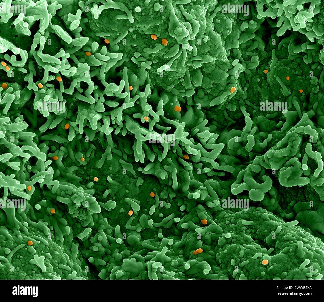 Colorized scanning electron micrograph of monkeypox virus (orange) on ...