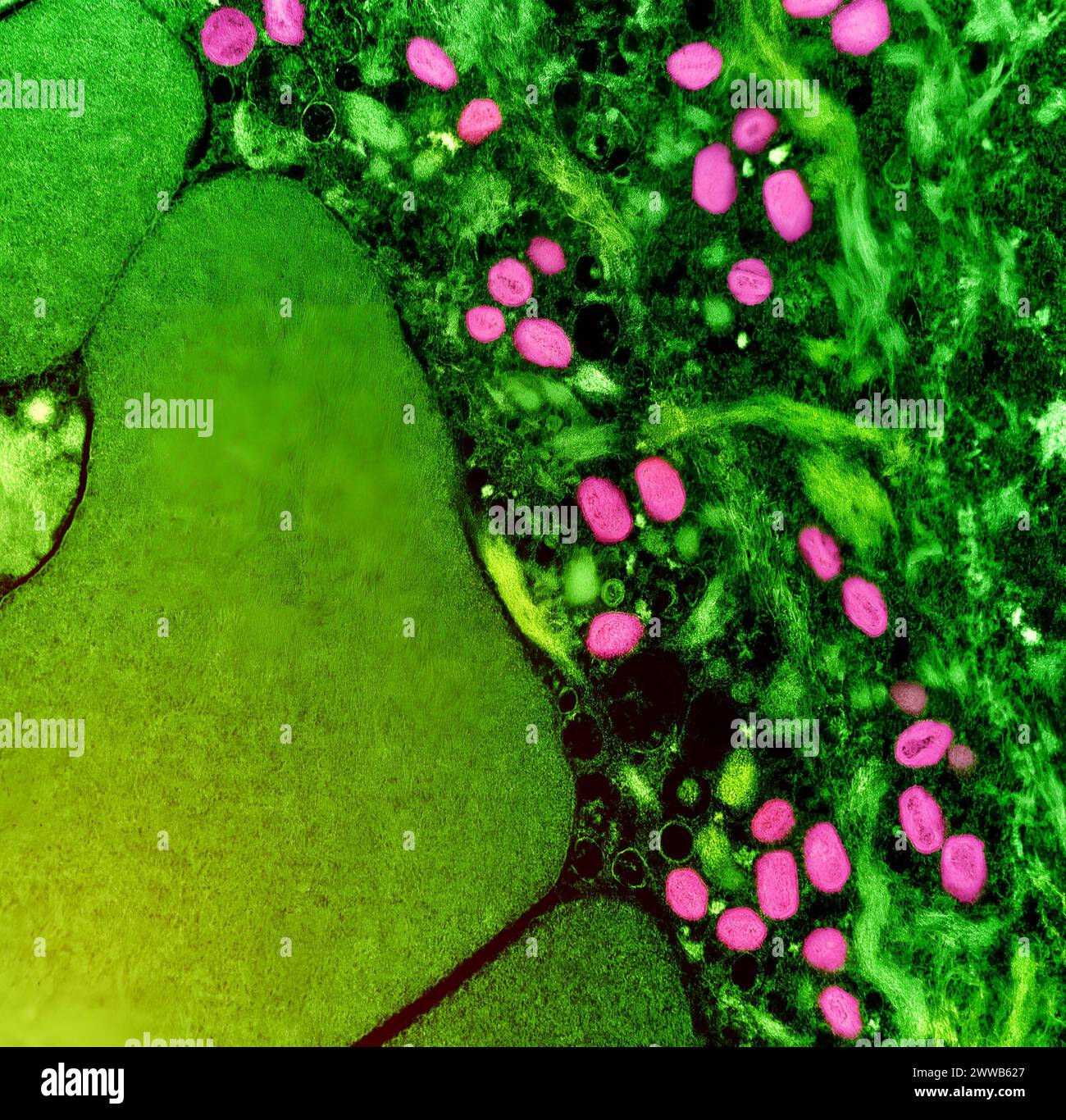 Colorized transmission electron micrograph of monkeypox particles (pink ...