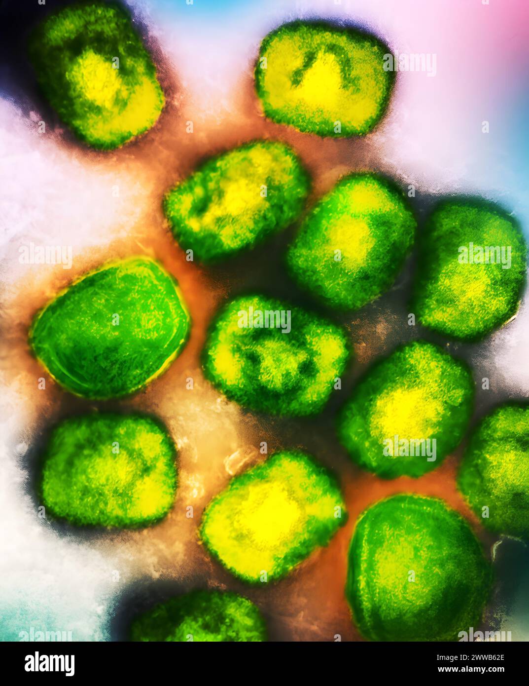 Colorized transmission electron micrograph of monkeypox virus particles ...