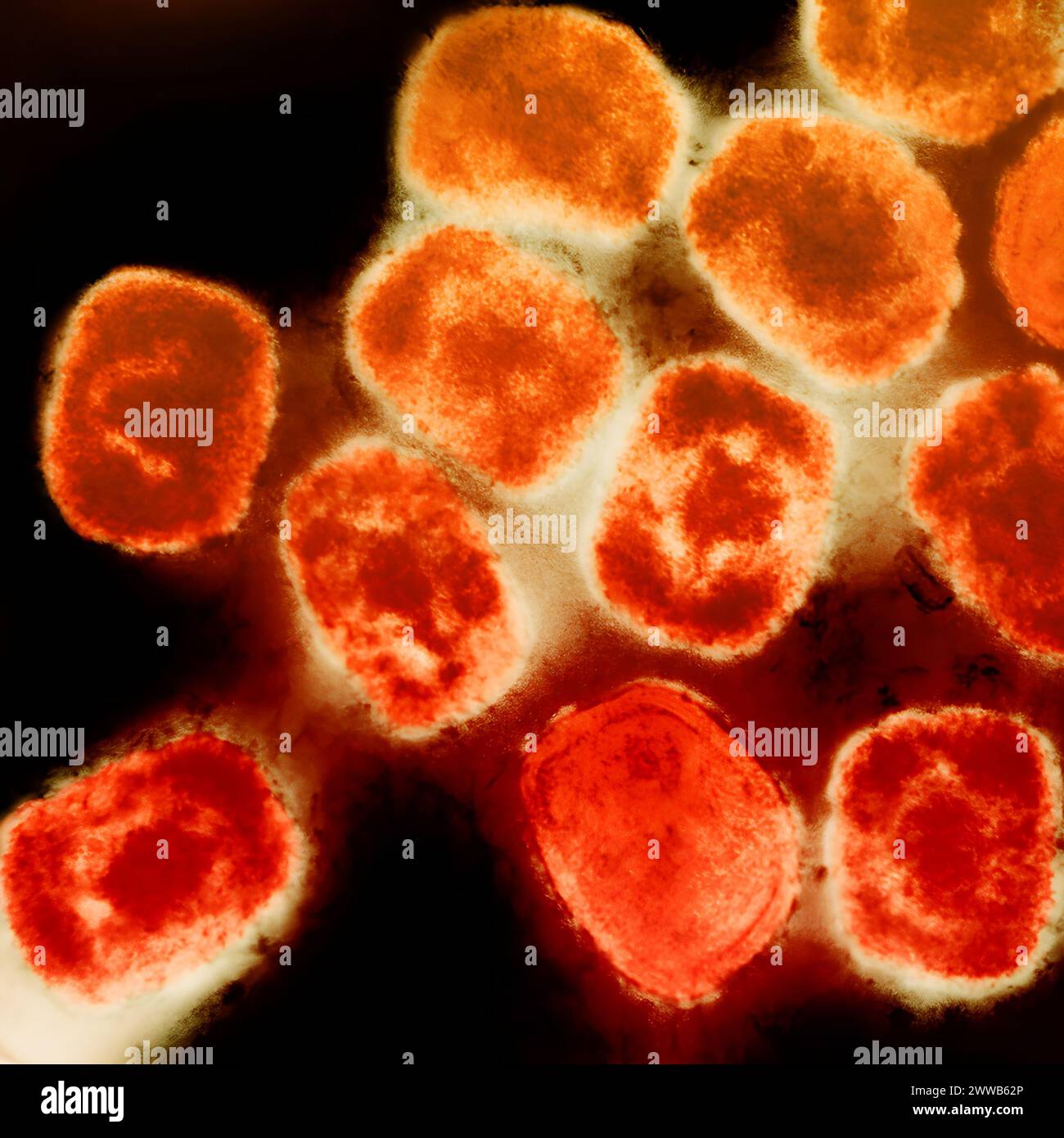 Colorized transmission electron micrograph of monkeypox virus particles ...