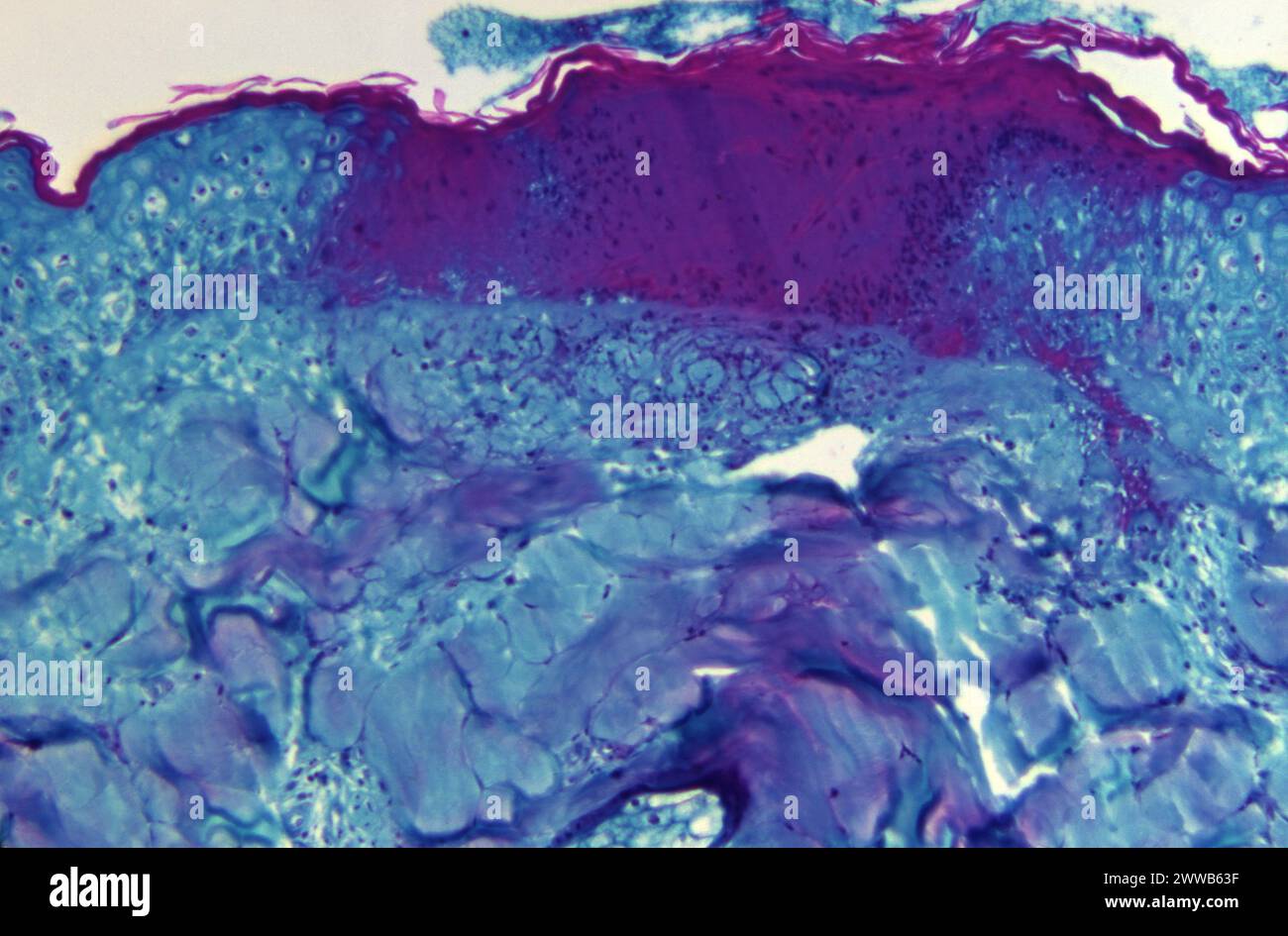 Epidemiology skin hi-res stock photography and images - Alamy