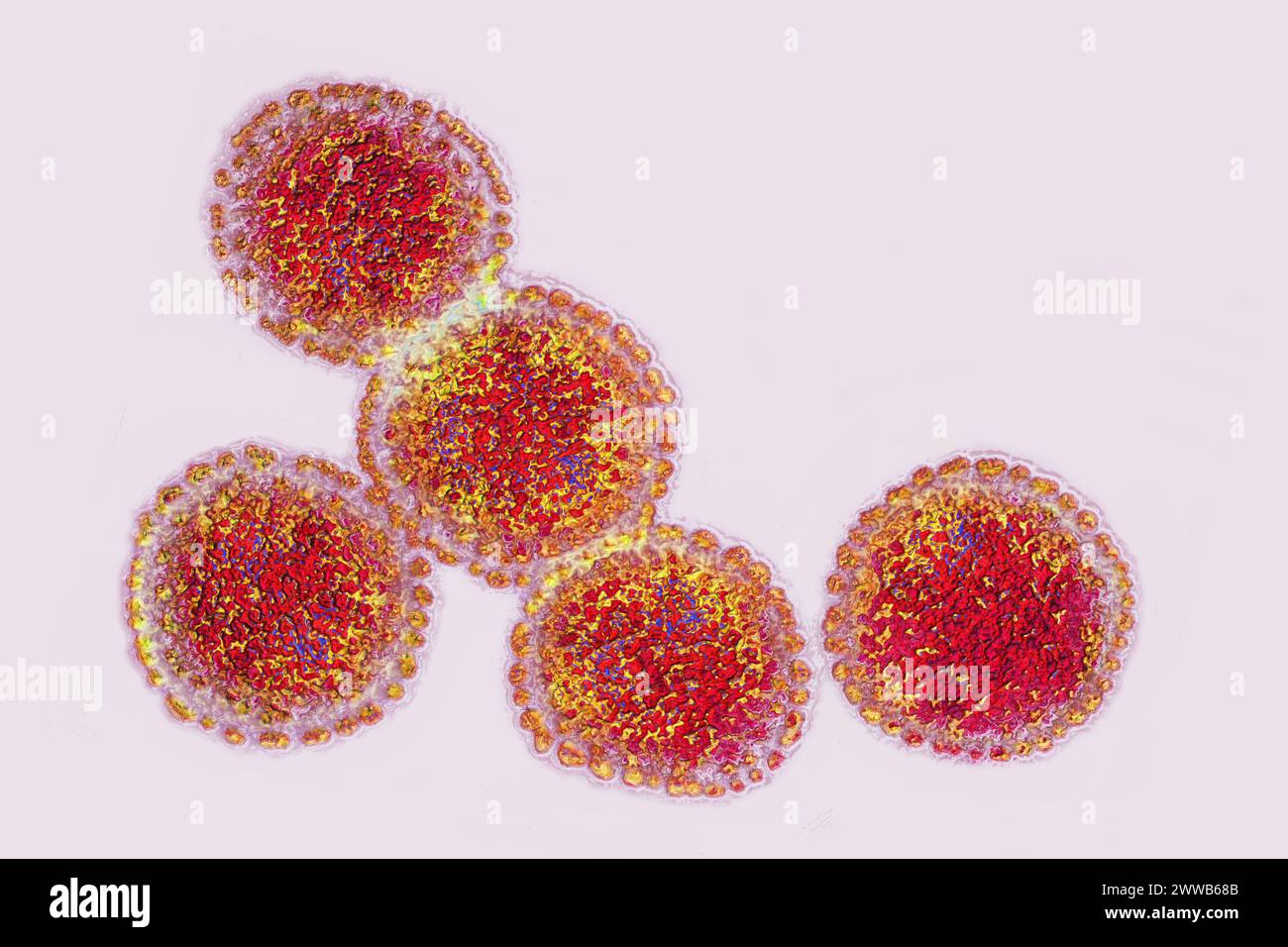 Influenza virus. Viruses of the Orthomyxoviridae family. Avian plague ...