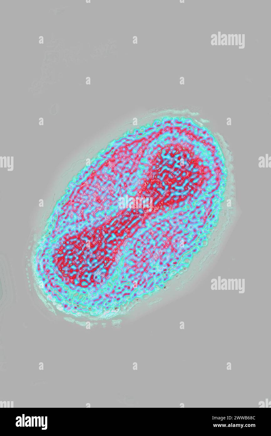 Smallpox virus microscope hi-res stock photography and images - Alamy