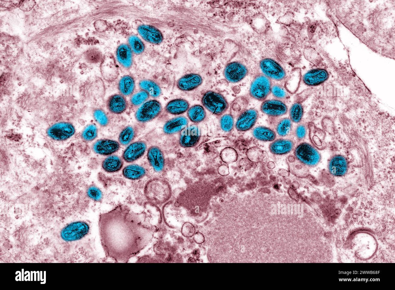 Smallpox virus microscope hi-res stock photography and images - Alamy