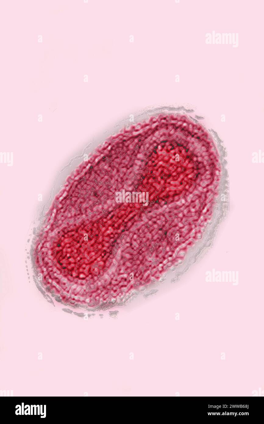 Smallpox virus microscope hi-res stock photography and images - Alamy