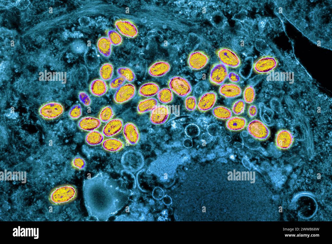 Smallpox virus microscope hi-res stock photography and images - Alamy