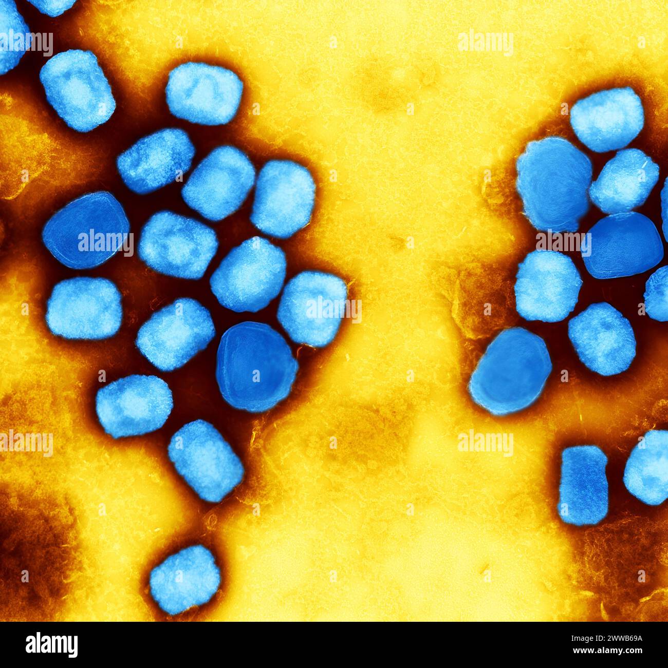 Colorized transmission electron micrograph of monkeypox virus particles ...